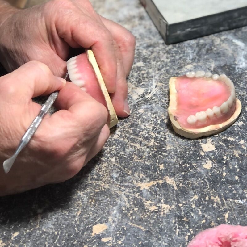 What You Need To Know To Get A Great Denture Reline