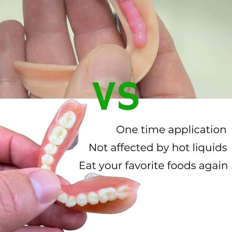 The Denture Adhesive Alternative-Lower Denture Stabilizers