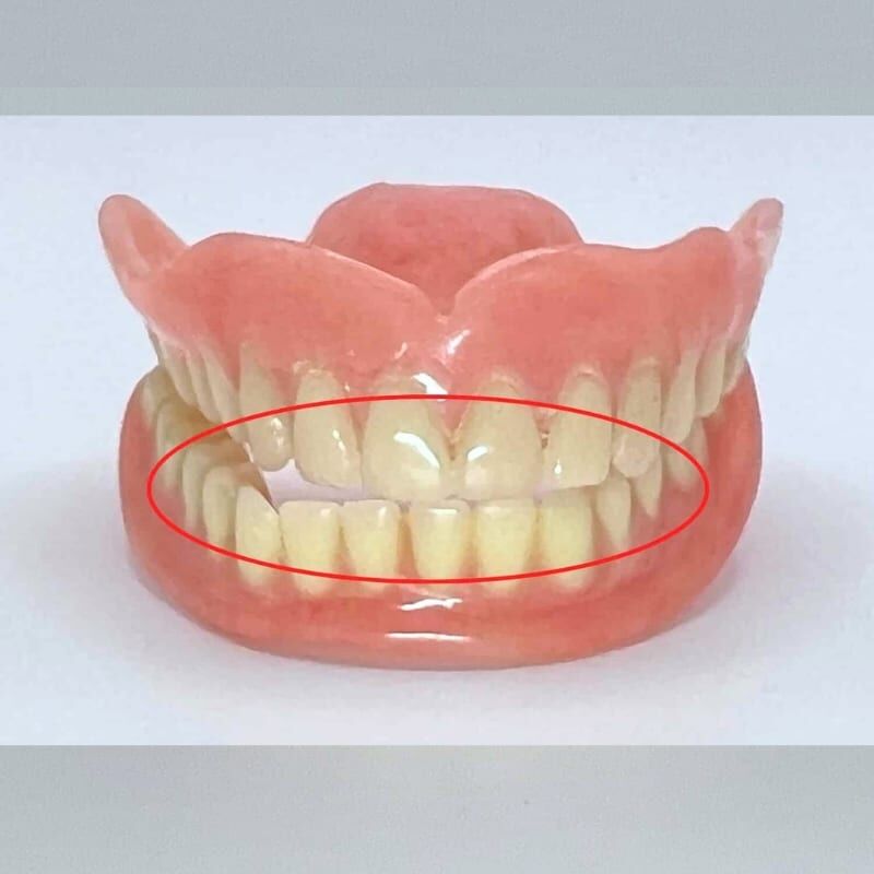 Troubleshooting Denture Problems