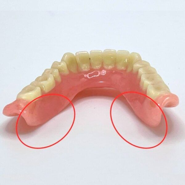 Troubleshooting Denture Problems