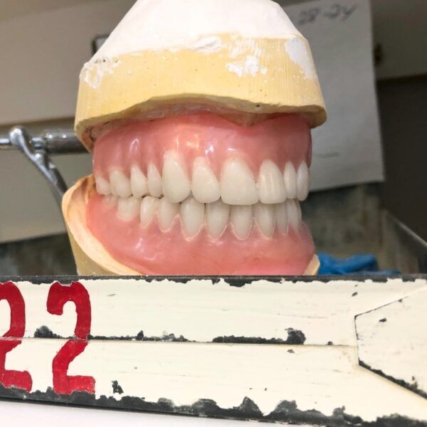 Troubleshooting Denture Problems