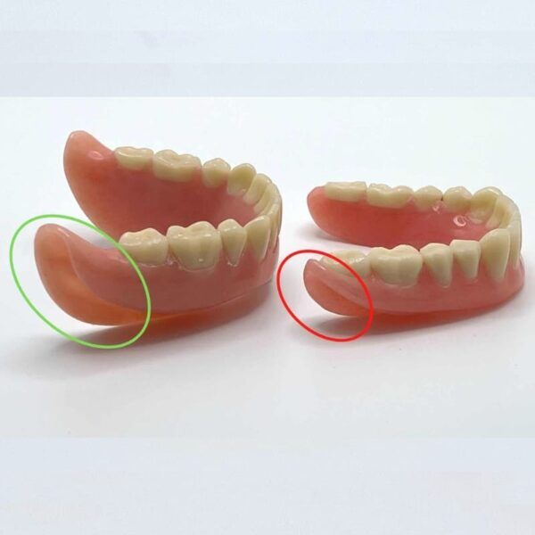 Troubleshooting Denture Problems