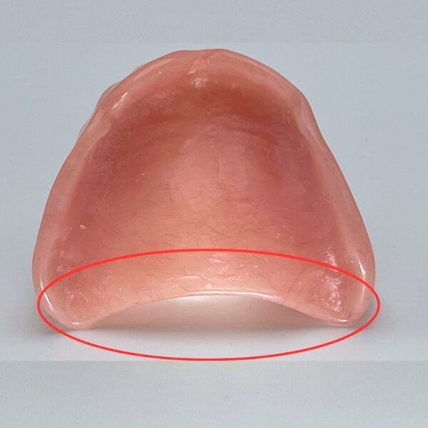 Troubleshooting Denture Problems