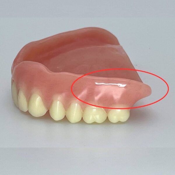 Troubleshooting Denture Problems